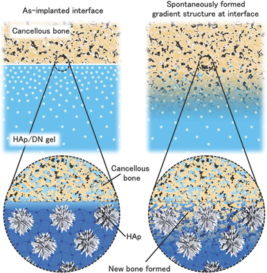 Double‐Network Hydrogels Strongly Bondable to Bones by Spontaneous ...