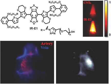Traumatic Brain Injury Imaging in the Second Near‐Infrared Window with ...