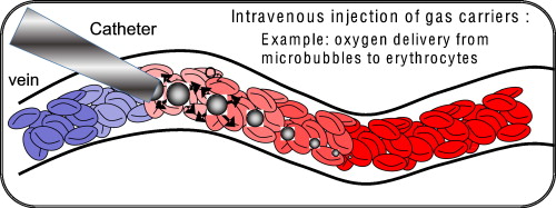 Therapeutic gas delivery via microbubbles and liposomes,Journal of ...