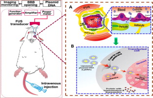 Focused ultrasound-induced blood-brain barrier opening for non-viral, non-invasive, and targeted ...