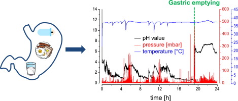 Intragastric pH and pressure profiles after intake of the high-caloric ...