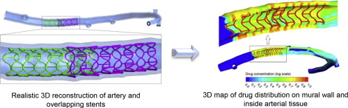 带有重叠药物洗脱支架的冠状动脉中的药物沉积,Journal of Controlled Release - X-MOL