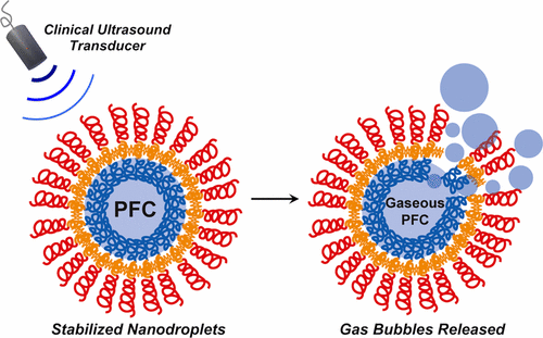 Polymer-Stabilized Perfluorobutane Nanodroplets for Ultrasound Imaging ...