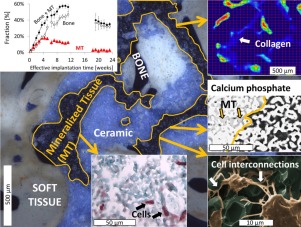机械能的矿化组织在β-磷酸三钙骨替代物的微孔中的分布特征,Materials Today - X-MOL