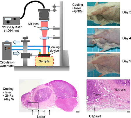 Photothermal therapy of tumors in lymph nodes using gold nanorods and ...