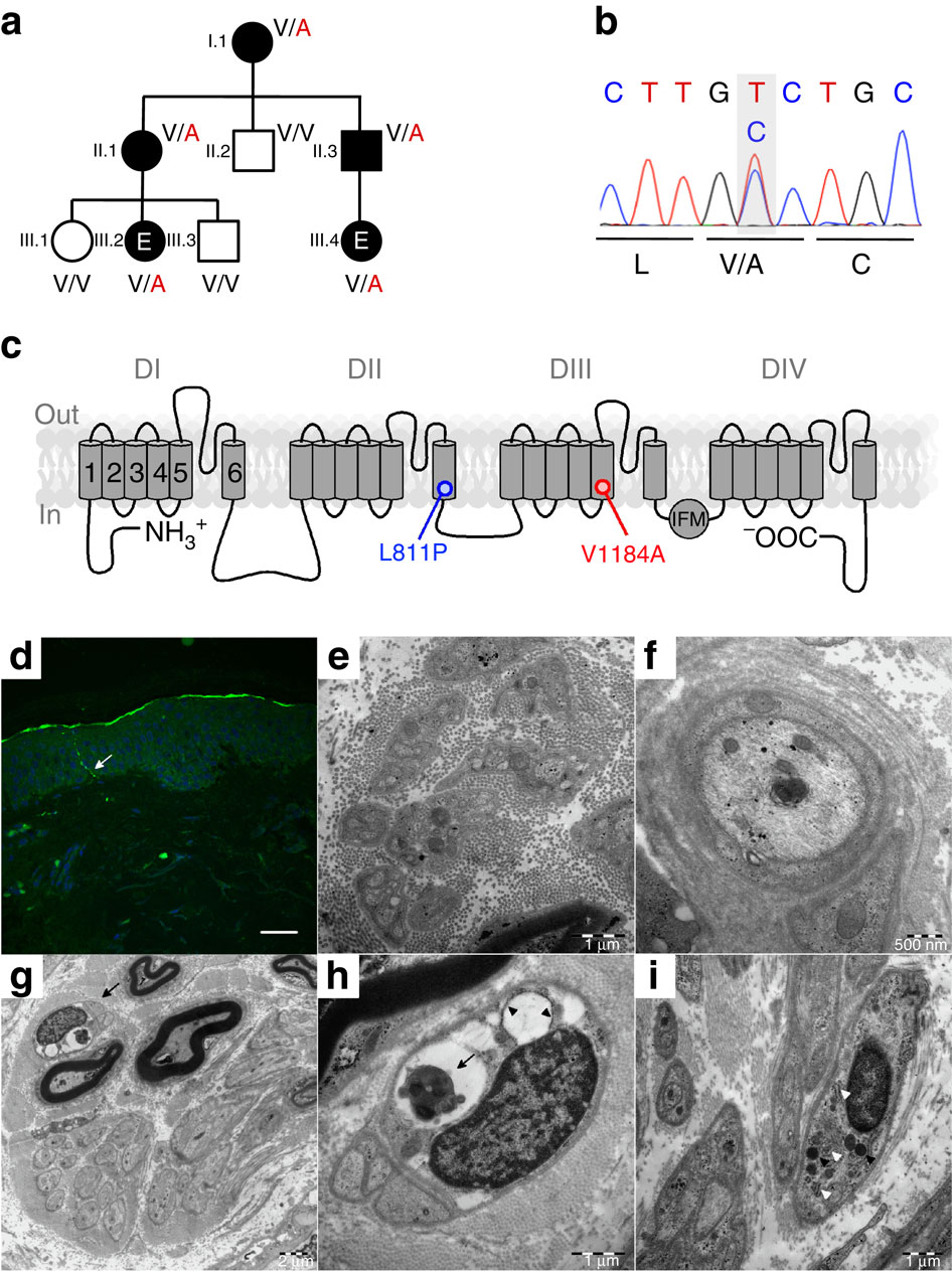 NaV1.9通道过度活跃突变引起的人的冷加重疼痛。,Nature Communications - X-MOL