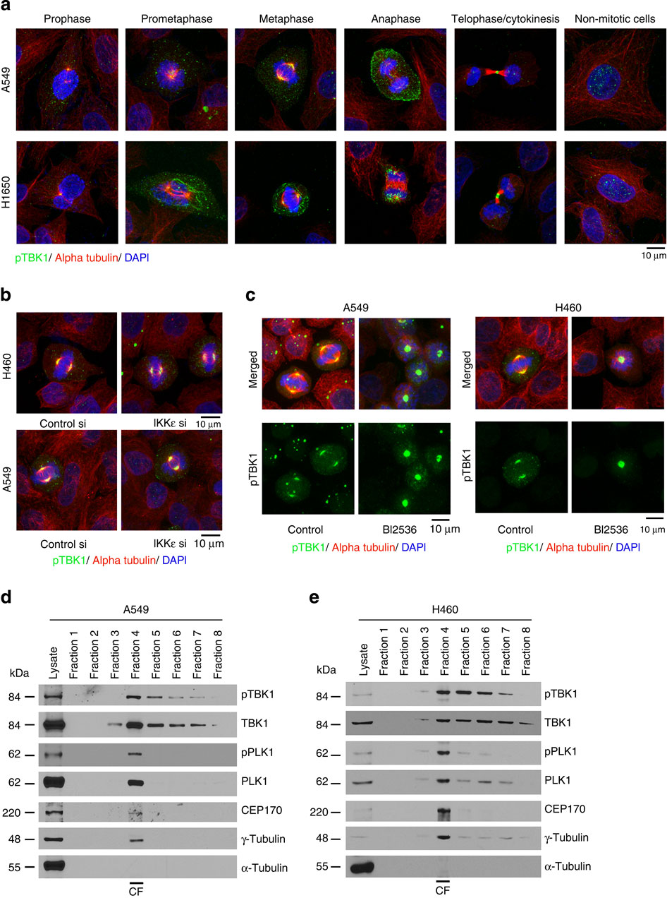 Tank binding kinase 1 is a centrosome-associated kinase necessary for ...