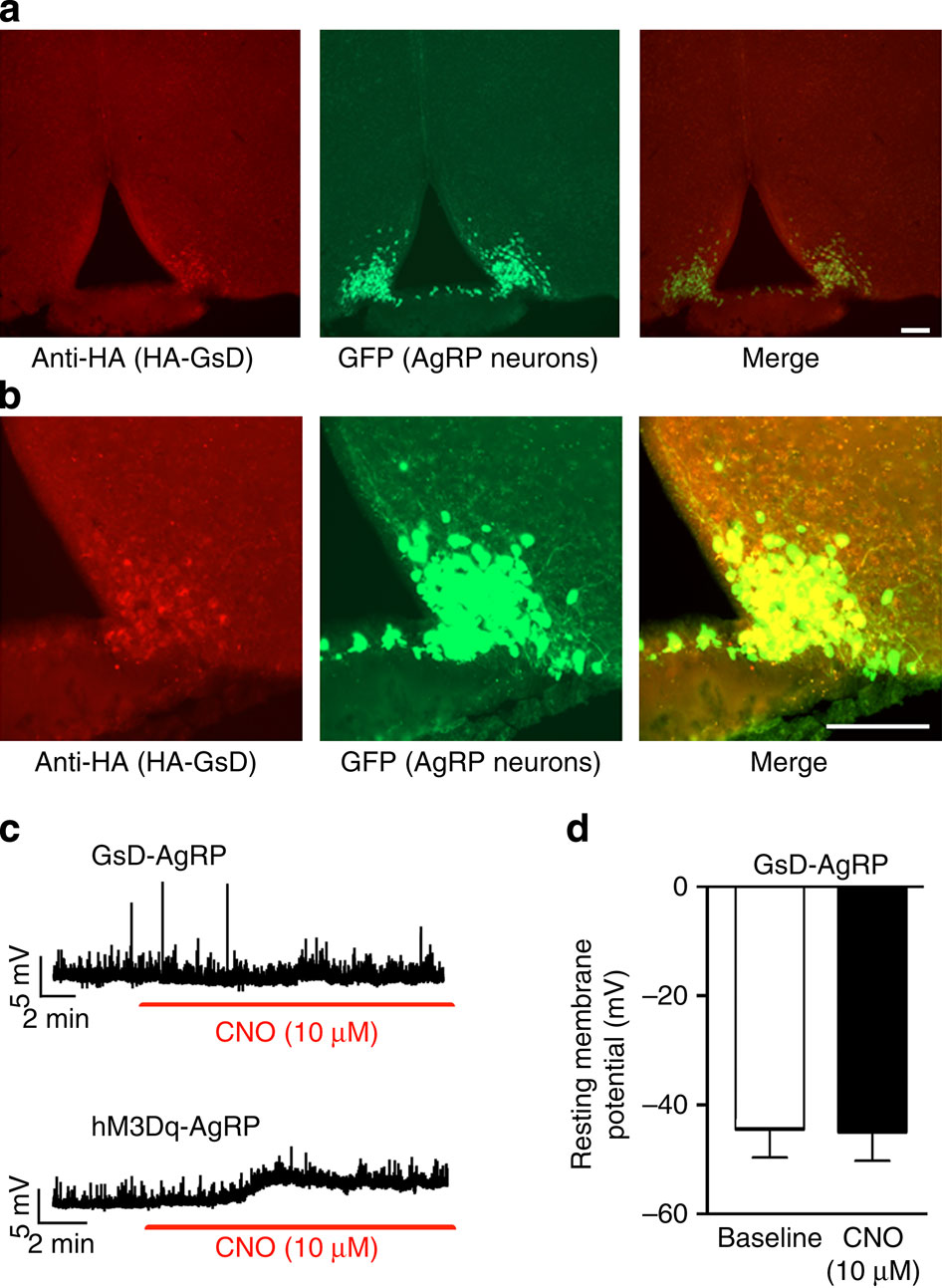 AgRP神经元中的Gs偶联GPCR信号触发食物摄入量的持续增加。,Nature Communications - X-MOL