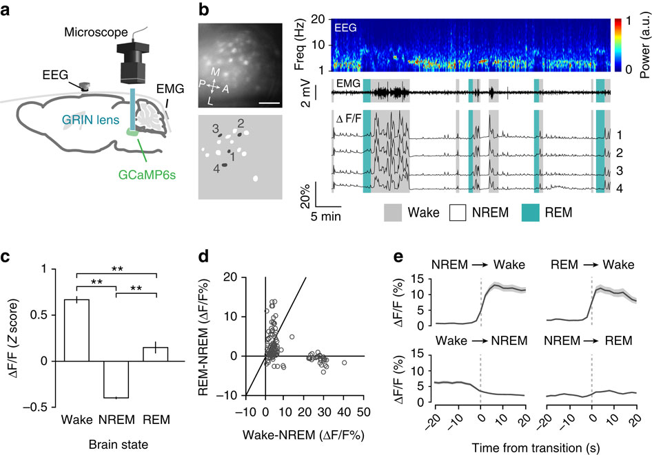 Calcium imaging of sleep-wake related neuronal activity in the dorsal ...
