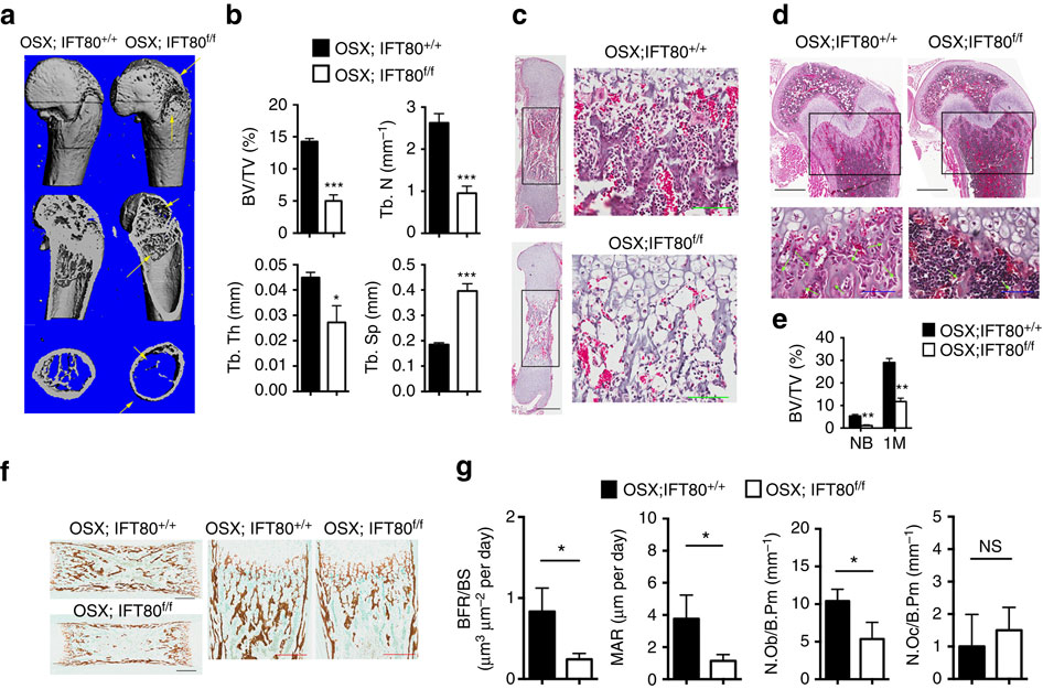 Ciliary IFT80 balances canonical versus non-canonical hedgehog ...