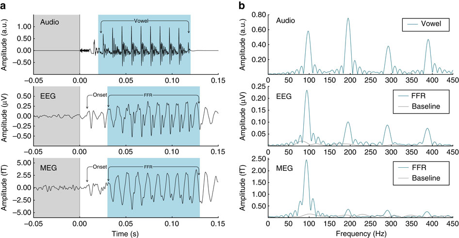 Cortical contributions to the auditory frequency-following response ...