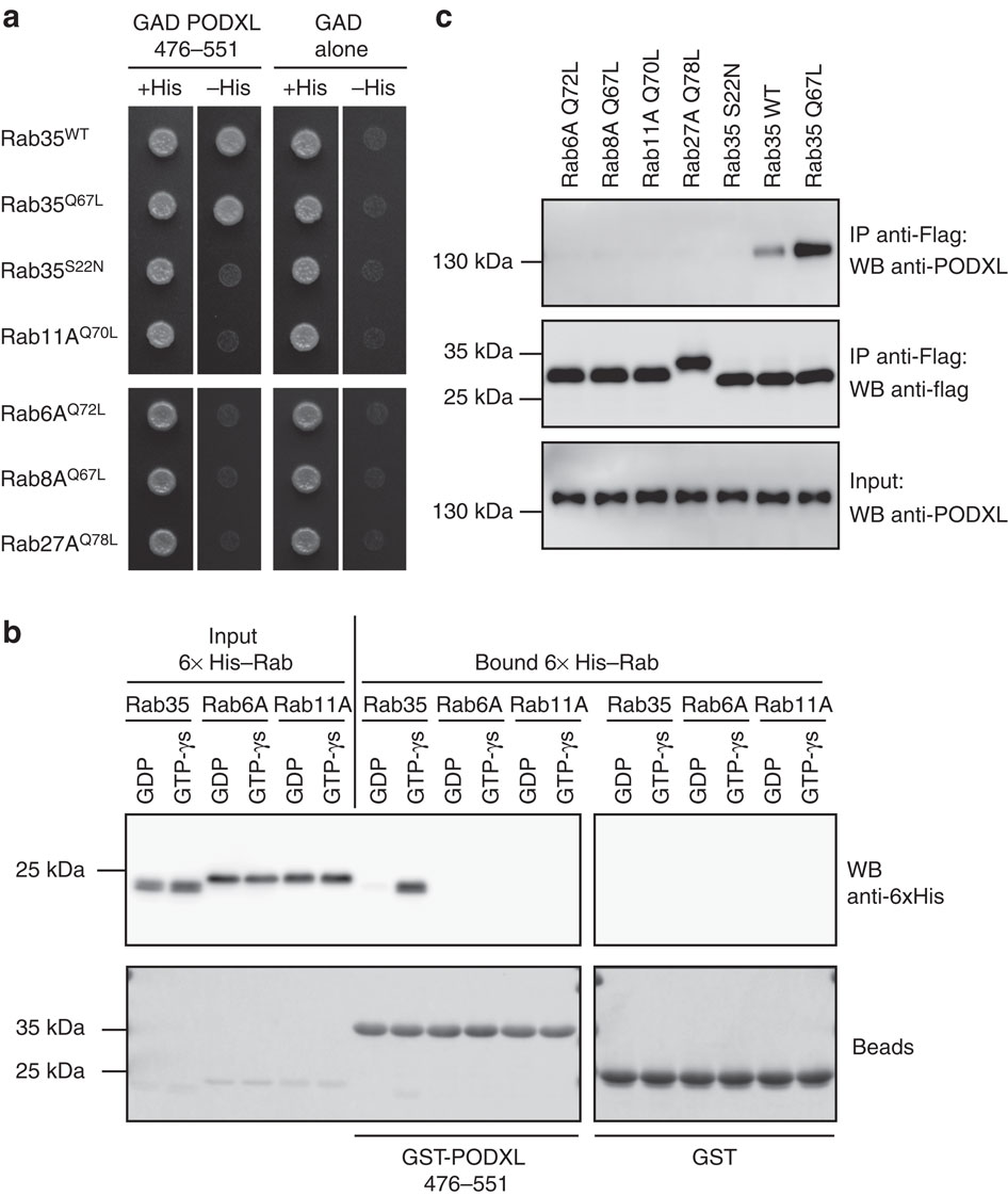 Rab35 GTPase将细胞分裂与上皮apico-基础极性的启动和管腔开放耦合。,Nature Communications - X-MOL