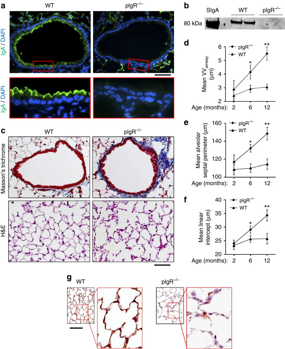 Airway bacteria drive a progressive COPD-like phenotype in mice with ...
