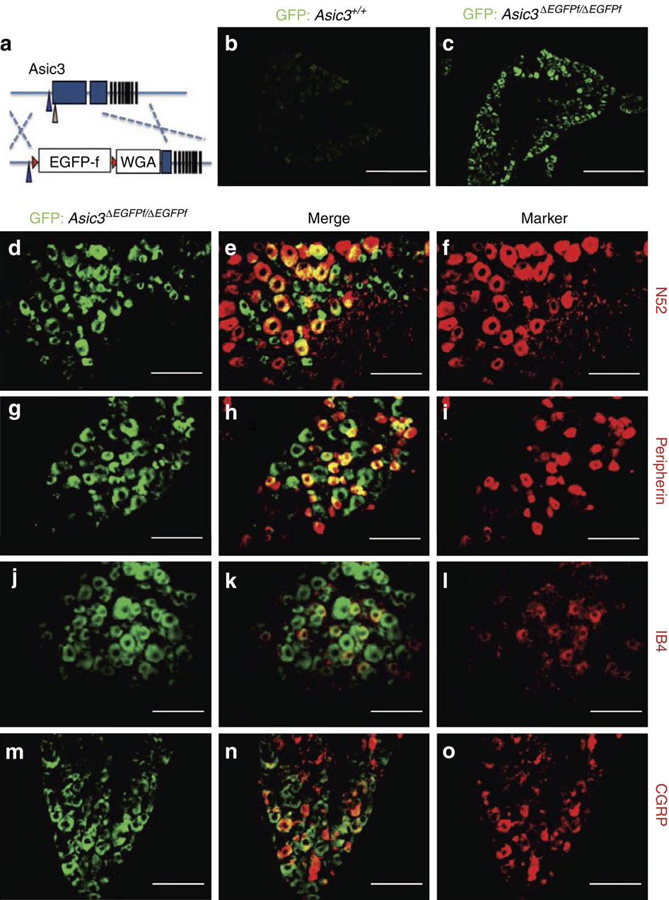 ASIC3 参与本体感受器感觉机械转导的证据。,Nature Communications - X-MOL