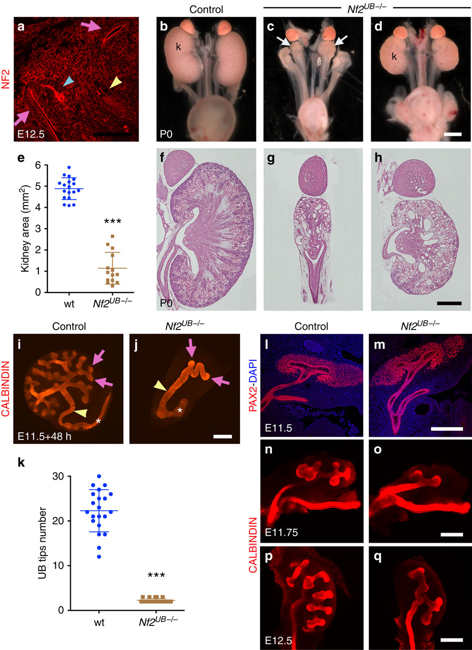 A critical role for NF2 and the Hippo pathway in branching ...