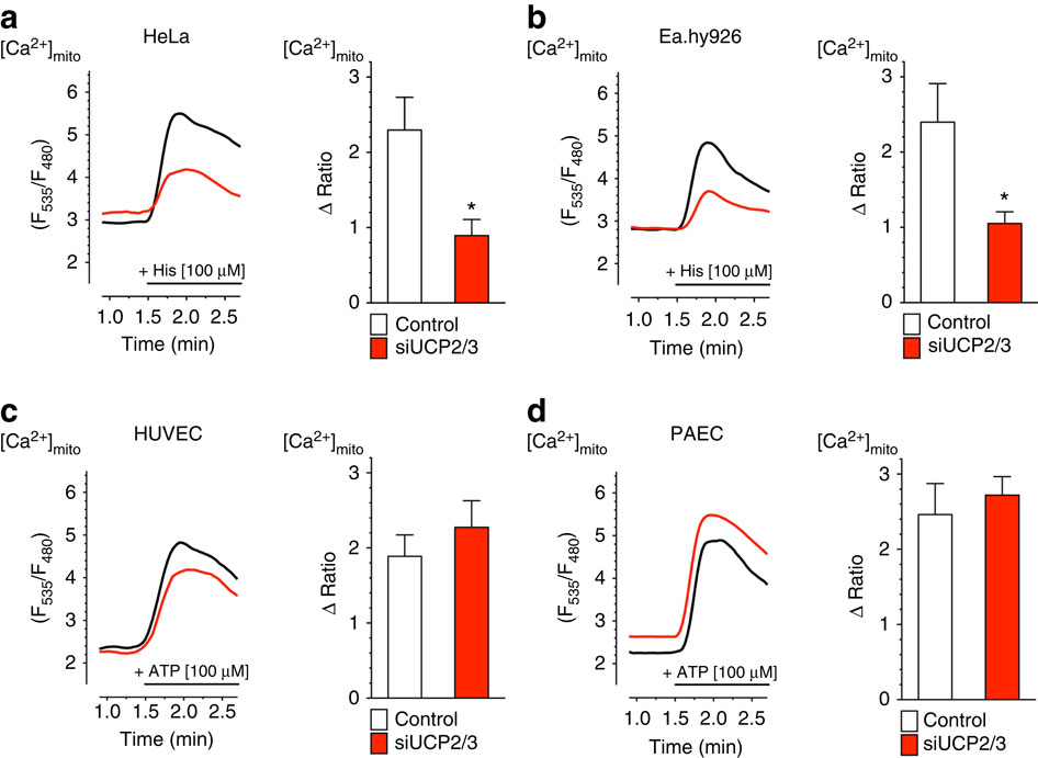 PRMT1-mediated methylation of MICU1 determines the UCP2/3 dependency of ...