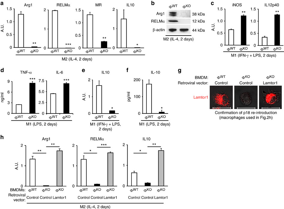 M2巨噬细胞的极化需要整合细胞因子和氨基酸信号的Lamtor1。,Nature Communications - X-MOL