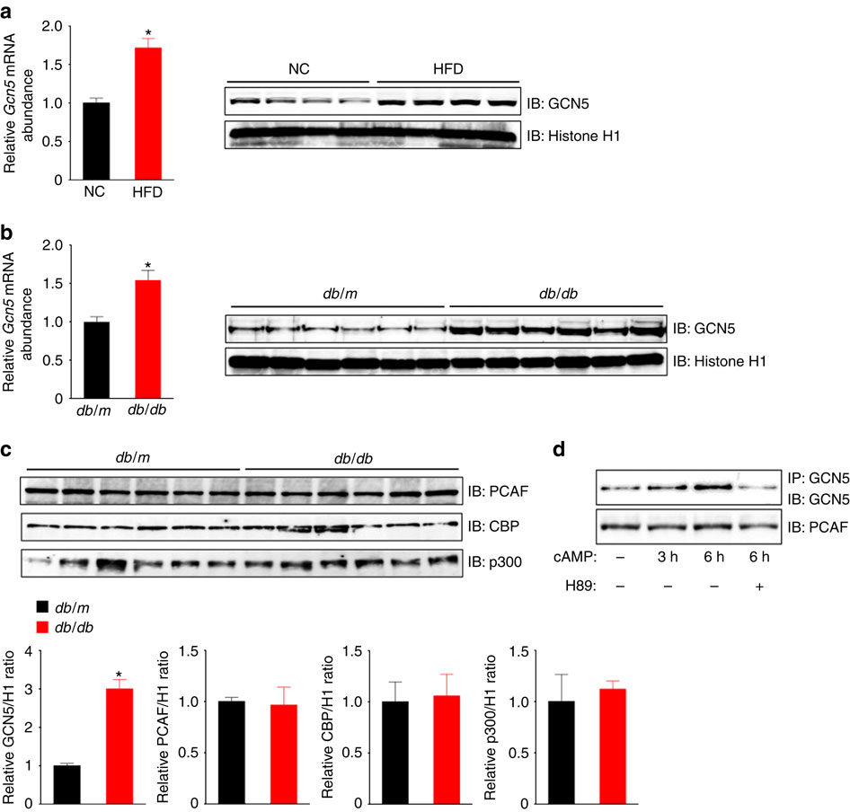 GCN5-CITED2-PKA信号模块通过cAMP诱导的底物开关控制肝糖代谢。,Nature Communications - X-MOL