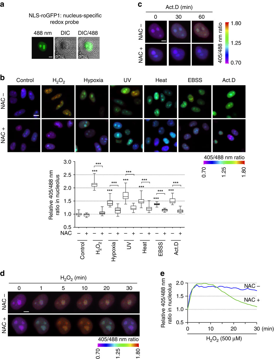 A redox mechanism underlying nucleolar stress sensing by nucleophosmin ...