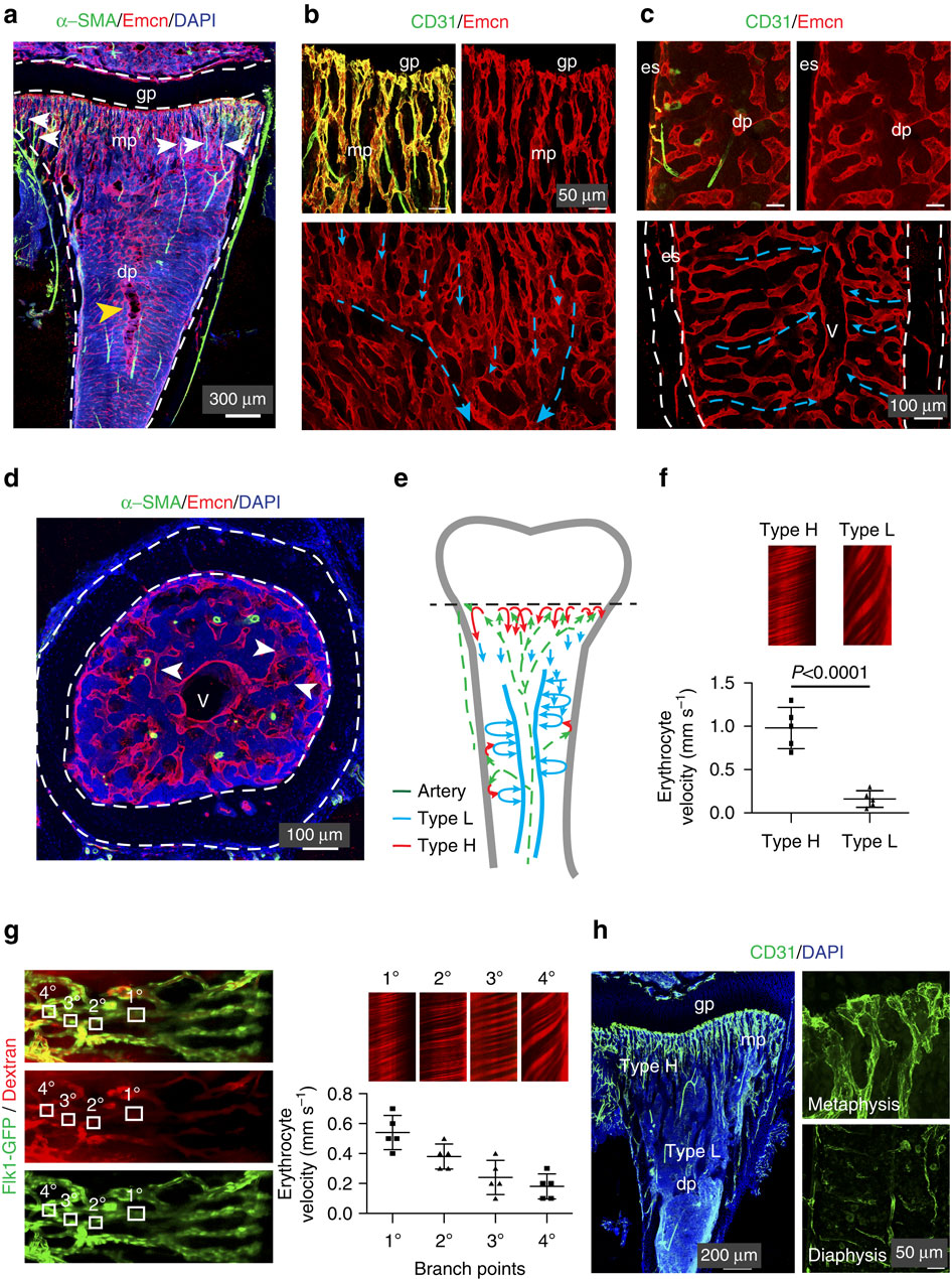 血流控制着骨骼的血管功能和成骨作用。,Nature Communications - X-MOL