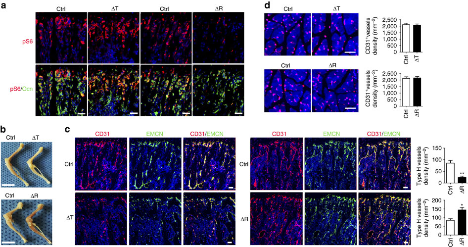 Osteoblasts secrete Cxcl9 to regulate angiogenesis in bone.,Nature ...