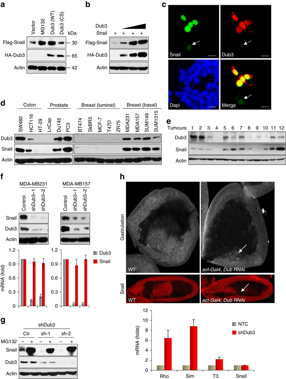 Dub3 抑制通过促进 Snail1 降解来抑制乳腺癌侵袭和转移。,Nature Communications - X-MOL