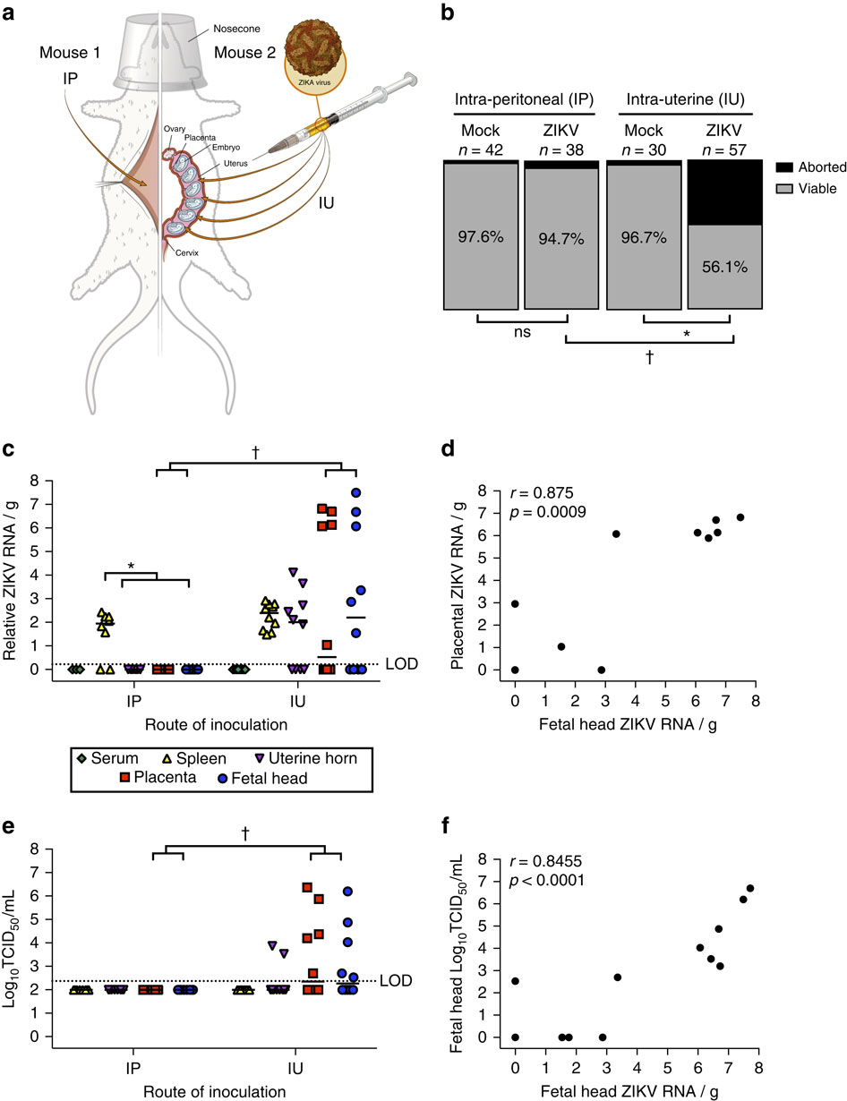 Intrauterine Zika virus infection of pregnant immunocompetent mice ...