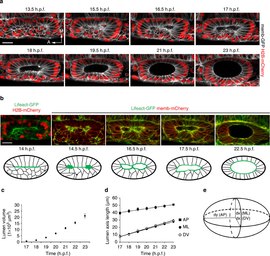 Mitotic cell rounding and epithelial thinning regulate lumen growth and ...