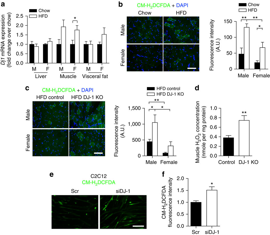 DJ-1 links muscle ROS production with metabolic reprogramming and ...