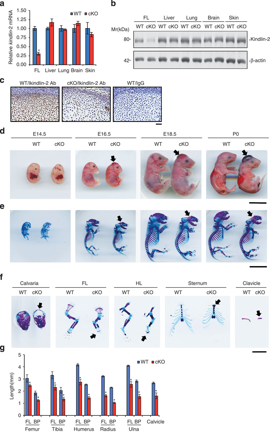 Kindlin-2控制TGF-β信号传导和Sox9表达以调节软骨形成。,Nature Communications - X-MOL