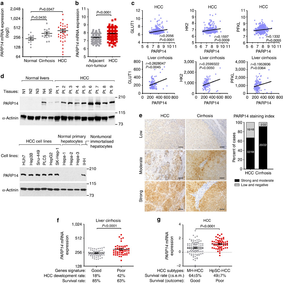PARP14 通过抑制 JNK1 依赖性 PKM2 磷酸化和激活来促进肝细胞癌中的 Warburg 效应。,Nature ...