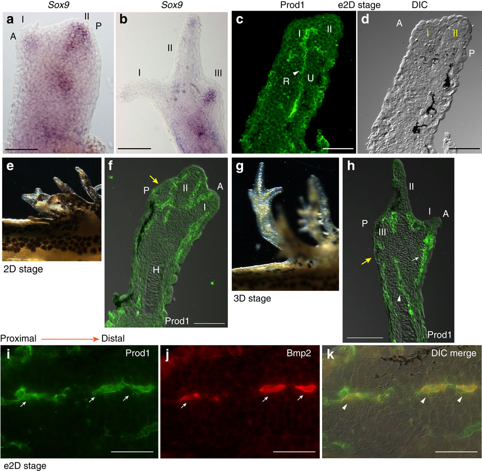 An orphan gene is necessary for preaxial digit formation during ...