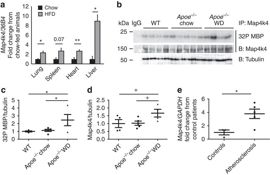 Endothelial protein kinase MAP4K4 promotes vascular inflammation and ...