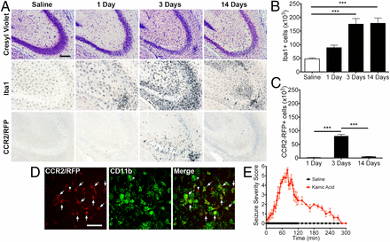 Infiltrating monocytes promote brain inflammation and exacerbate ...