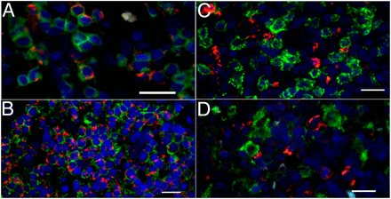 与血管免疫母细胞 T 细胞淋巴瘤相关的 IDH2 R172K 突变在 T 细胞中产生 2HG 并影响淋巴发育 [医学],Proceedings ...