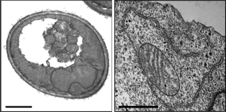 Autophagy wins the 2016 Nobel Prize in Physiology or Medicine ...
