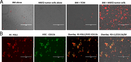 COX2 / mPGES1 / PGE2通路调节肿瘤相关巨噬细胞和髓样来源的抑制细胞中PD-L1的表达[免疫学和炎症],Proceedings ...