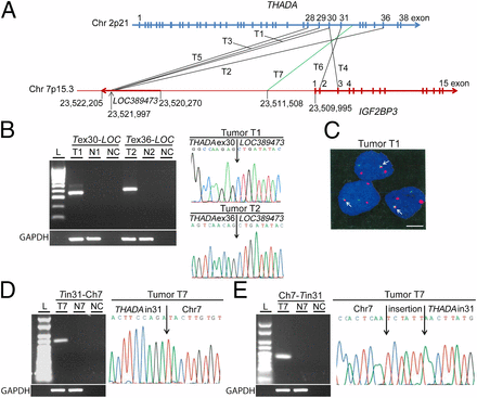 THADA fusion is a mechanism of IGF2BP3 activation and IGF1R signaling ...