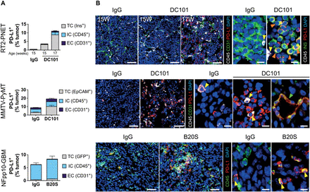 Combined antiangiogenic and anti–PD-L1 therapy stimulates tumor ...