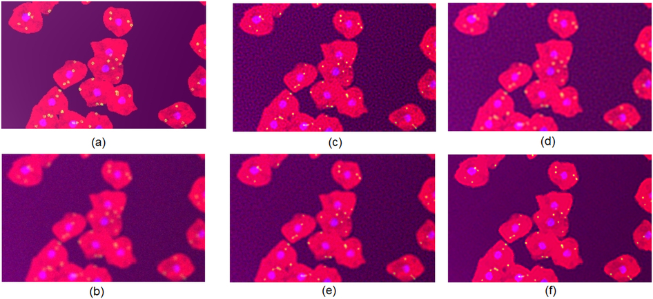 Bayesian-based deconvolution fluorescence microscopy using dynamically updated nonstationary ...