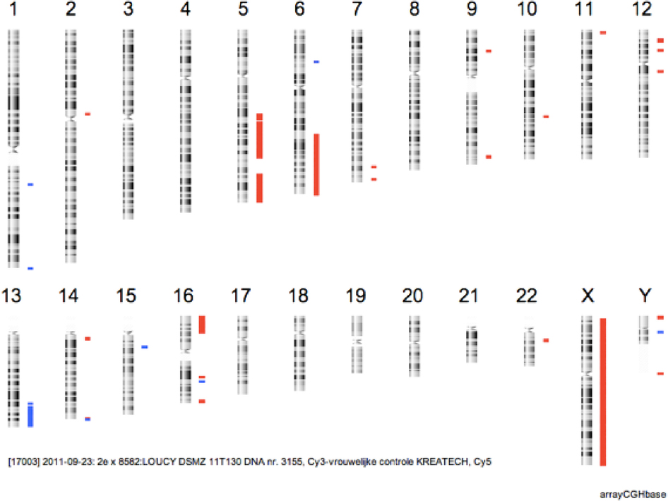 Whole genome amplification with SurePlex results in better copy number ...