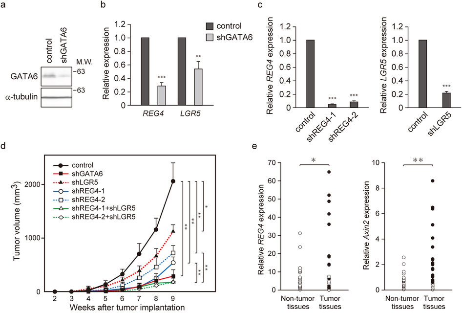 REG4 is a transcriptional target of GATA6 and is essential for colorectal tumorigenesis ...