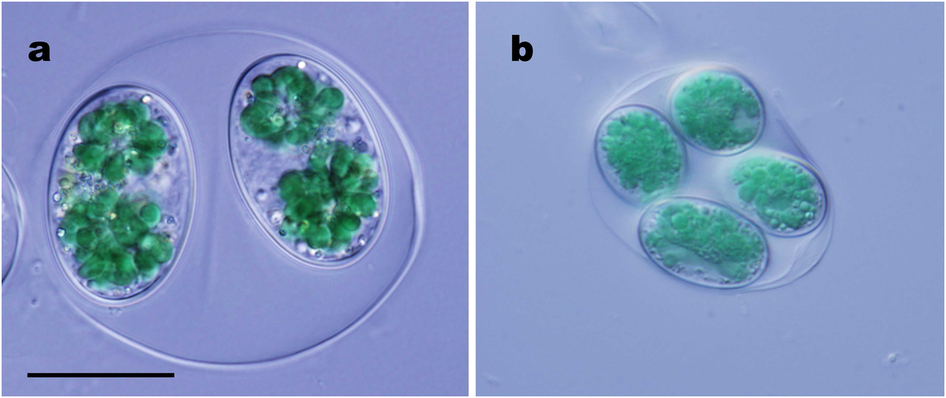 Ultra-high voltage electron microscopy of primitive algae illuminates ...