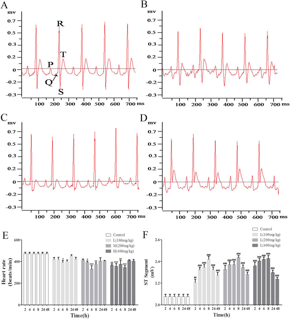 TXNIP/TRX/NF-κB and MAPK/NF-κB pathways involved in the cardiotoxicity ...