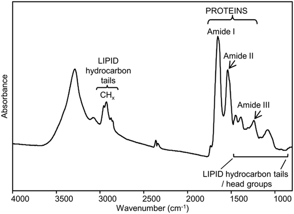 In situ characterization of protein aggregates in human tissues ...