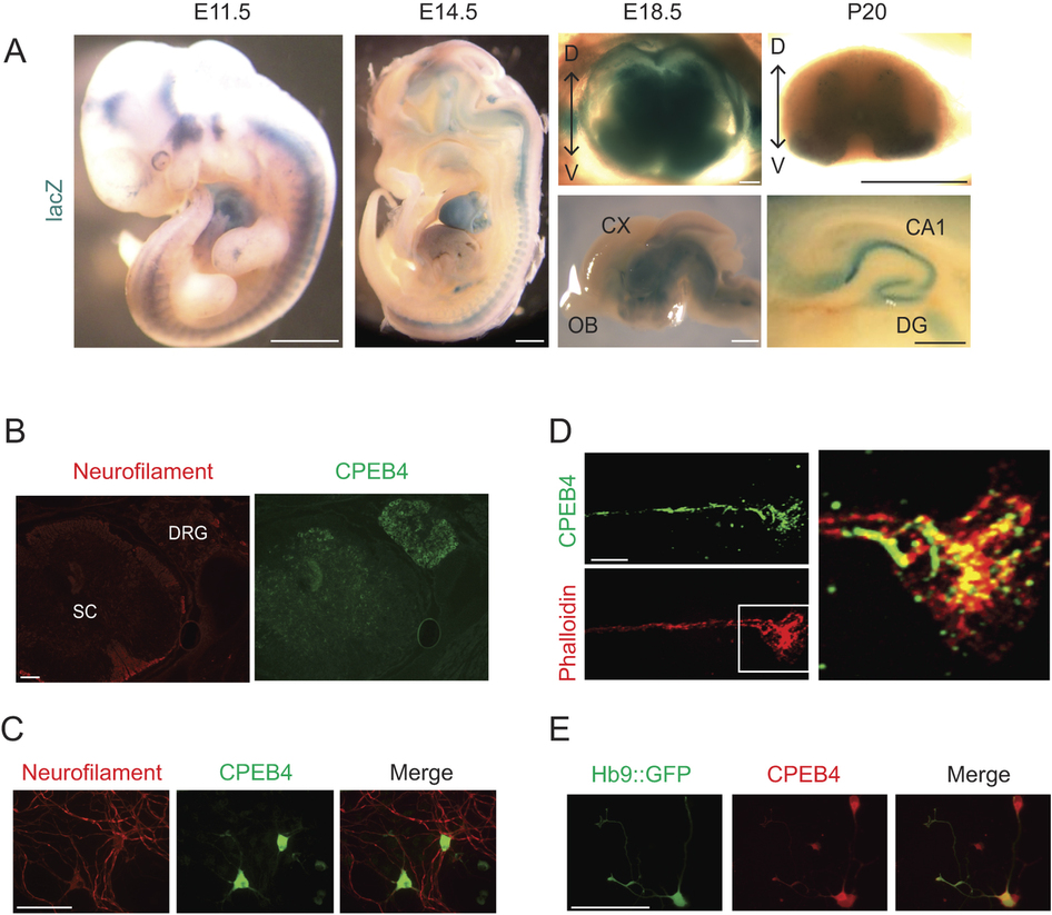 Impaired neurodevelopment by the low complexity domain of CPEB4 reveals ...