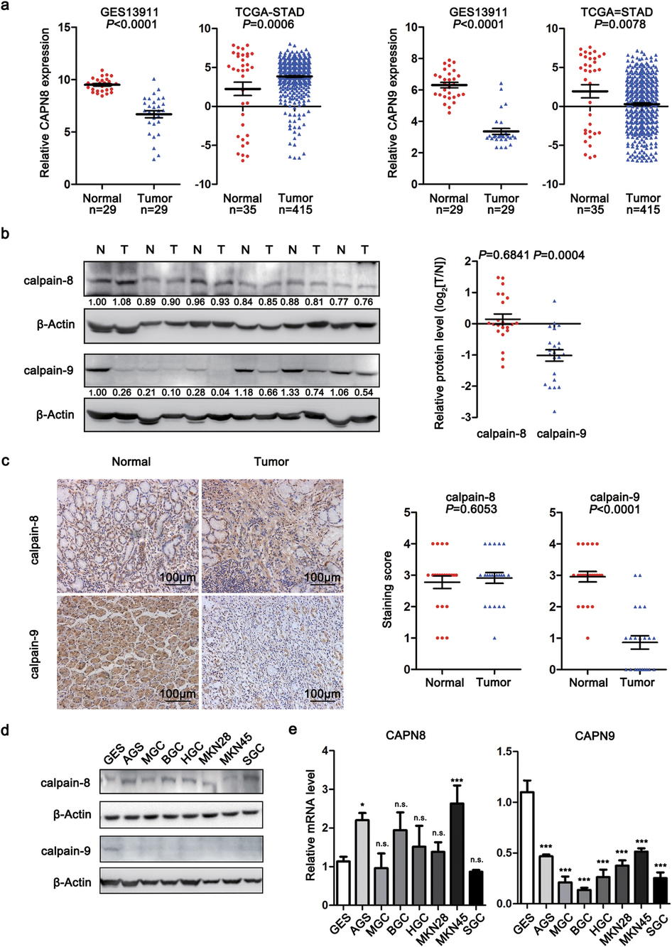 Decreased expression of Calpain-9 predicts unfavorable prognosis in ...