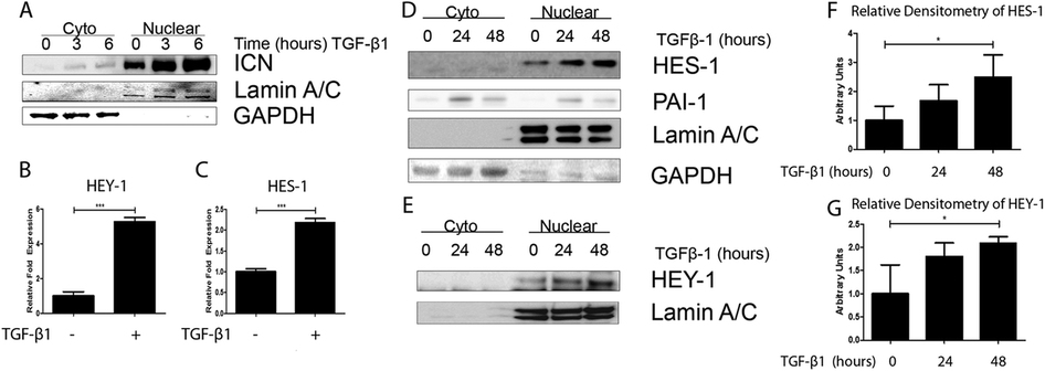 HDAC6对TGF-β1激活Notch1的要求。,Scientific Reports - X-MOL