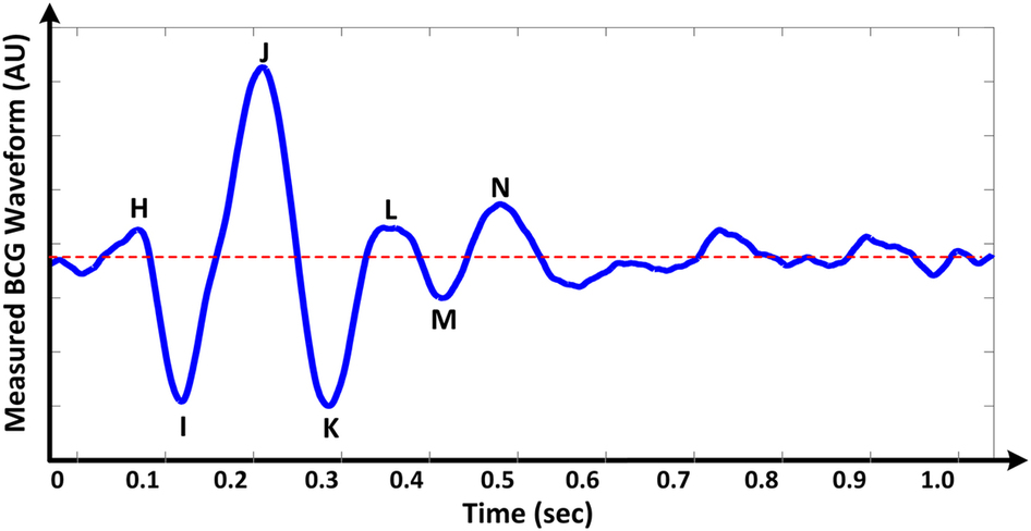 Ballistocardiogram: Mechanism and Potential for Unobtrusive ...