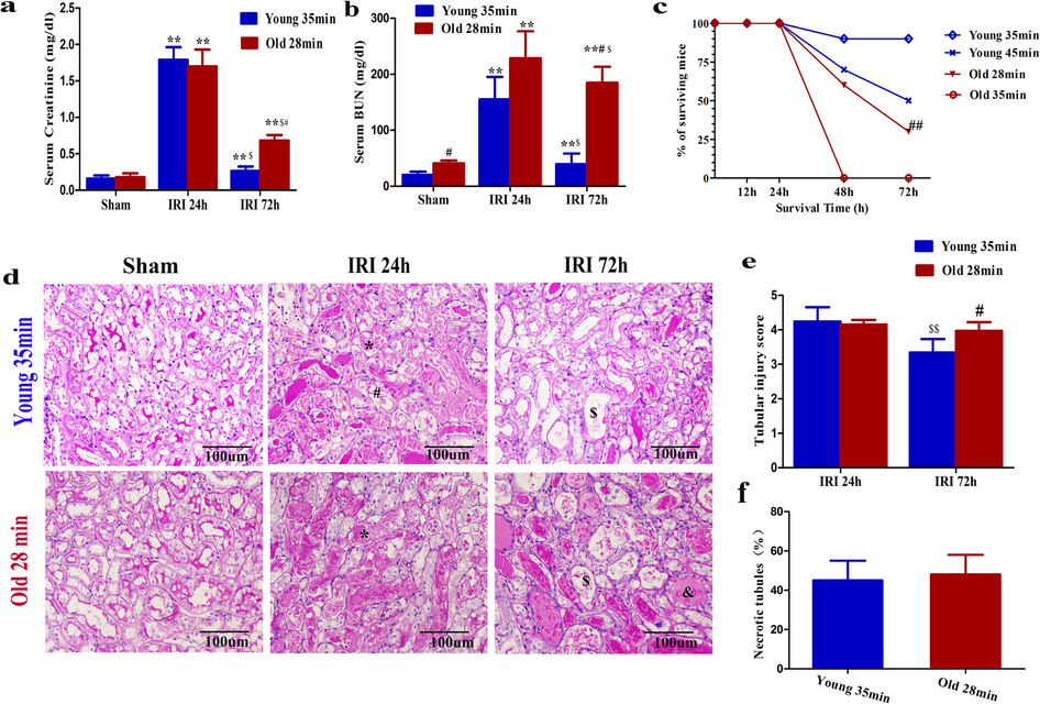 GDF11改善老年小鼠急性肾损伤后的肾小管再生。,Scientific Reports - X-MOL